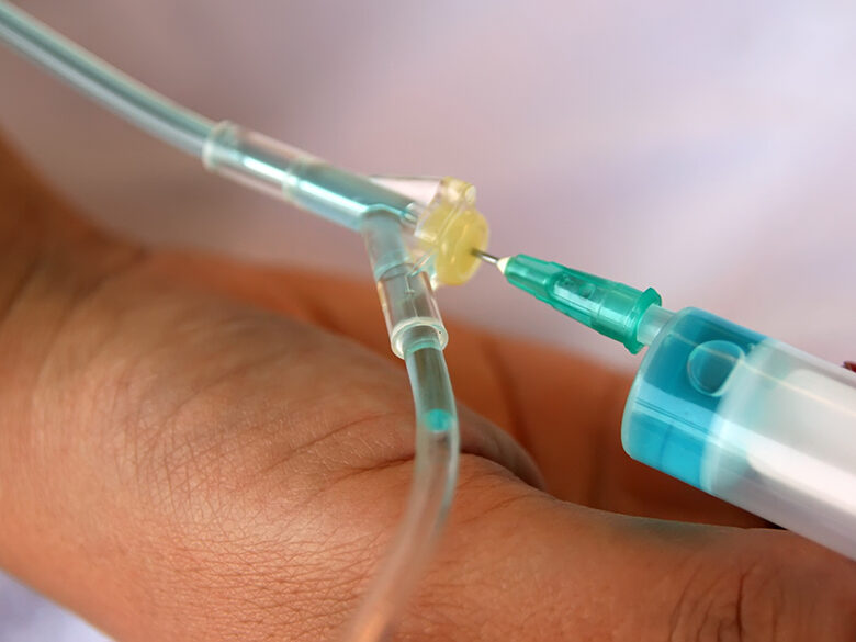 Gebärmutterentfernung: Vor- und Nachteile der Hysterektomie